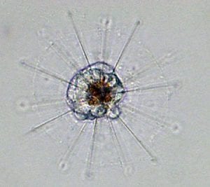 A Gallery of Protists - Woods Hole Oceanographic Institution