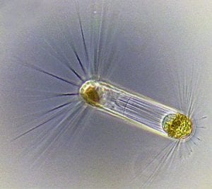 A Gallery of Protists – Woods Hole Oceanographic Institution