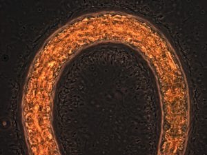 The Many Faces of Trichodesmium – Woods Hole Oceanographic Institution