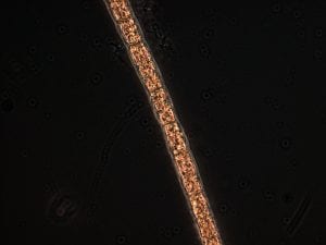 The Many Faces of Trichodesmium – Woods Hole Oceanographic Institution