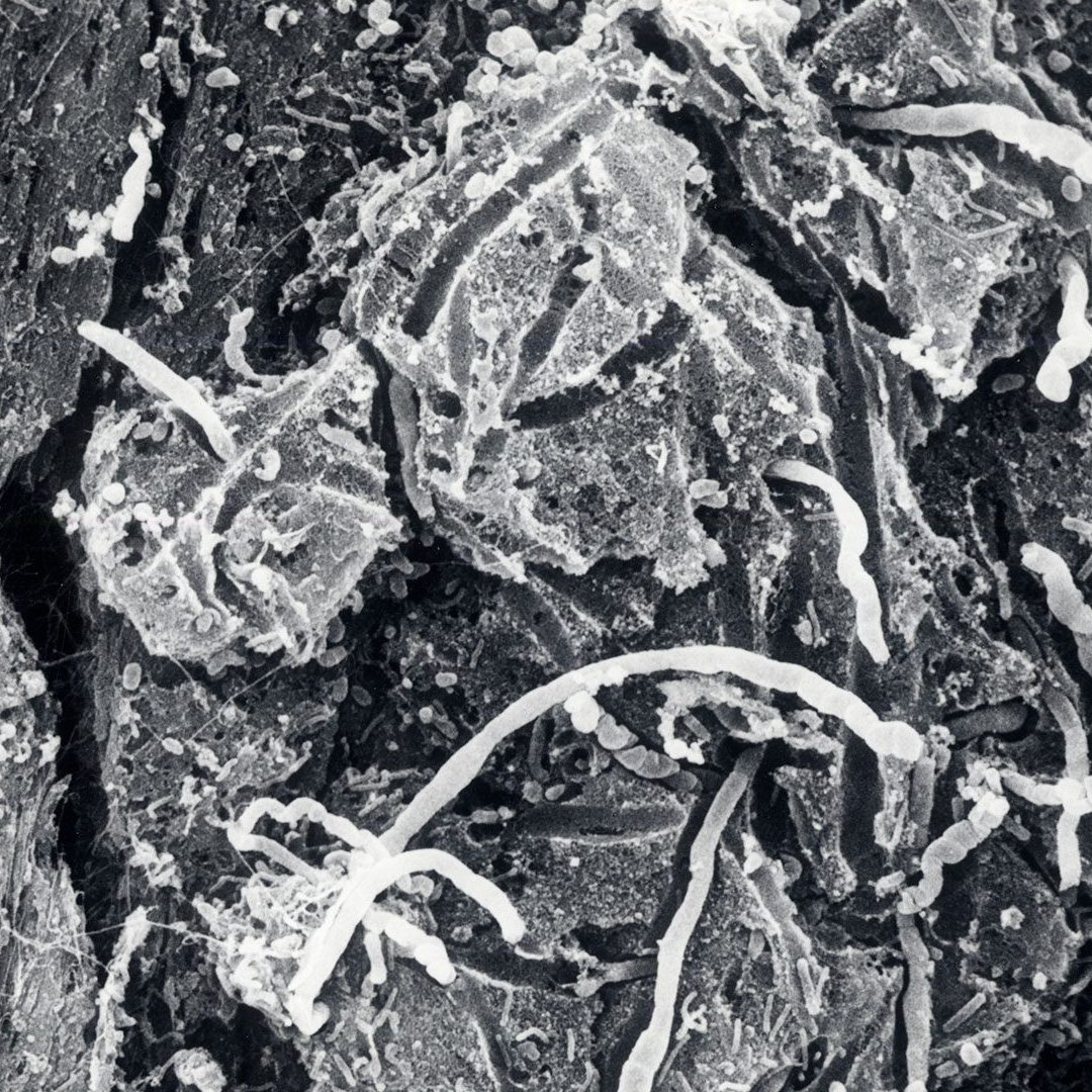 How do tiny marine microbes affect global carbon? - Woods Hole ...